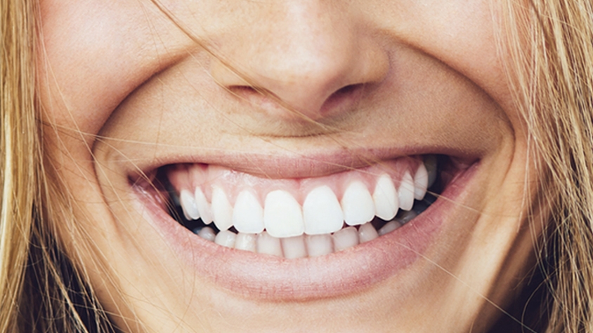 11億円の投資を受けた歯に装着する通話デバイス「Molar Mic」 | TABI LABO