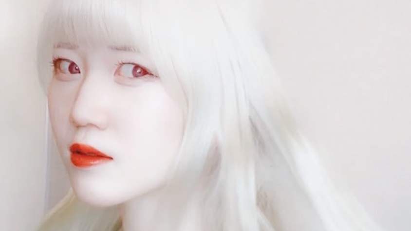 【となりのZ世代】アルビノ女子・りり香さん | TABI LABO